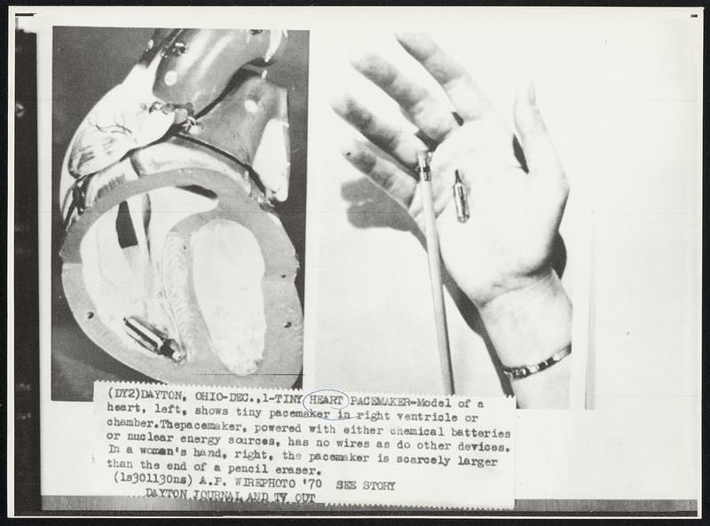 Tiny Heart Pacemaker-Model of a heart, left, shows tiny pacemaker in ...