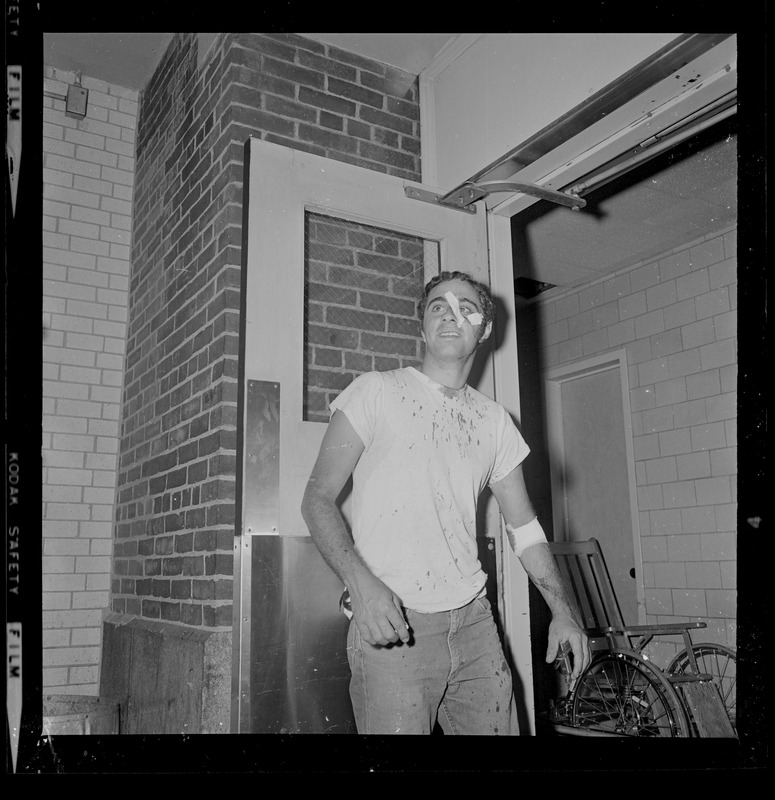 Construction worker Kenneth Kurker after sustaining injuries from a ...