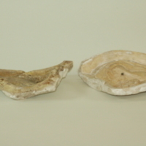 Dickinson-Belskie uterus mold, 1939-1950 - Digital Commonwealth